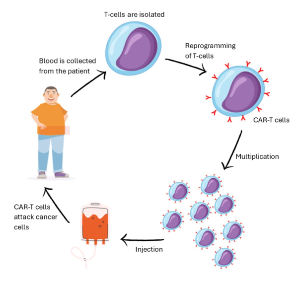 Research blog: Immunotherapy for blood cancers - the rise of CAR-T ...