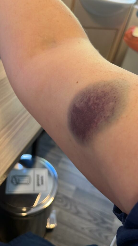 "Life will never be the same" - Megan's story - Leukaemia UK